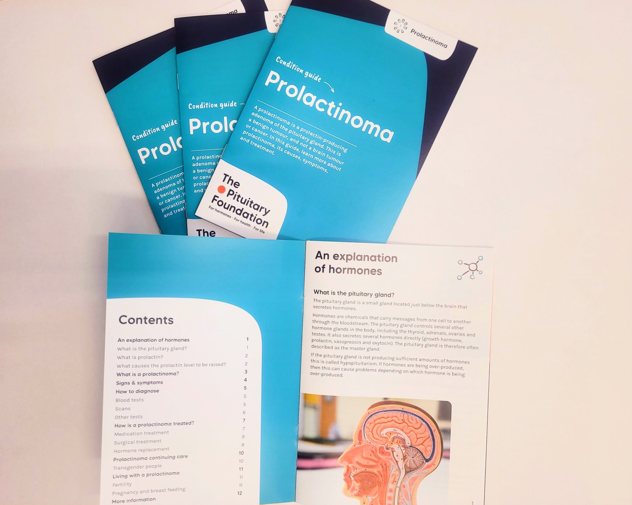 Prolactinoma Booklet - Pituitary Foundation