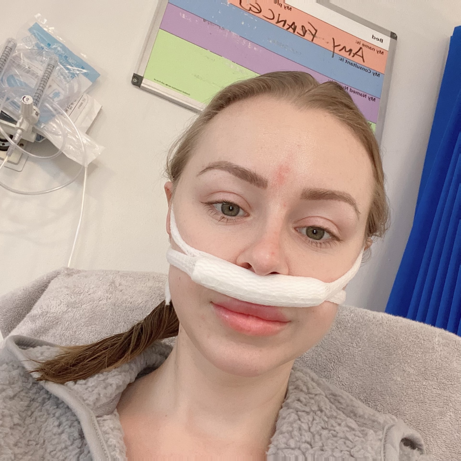 Amy's story - A 10 hour operation - Pituitary Foundation